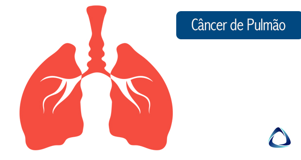 Câncer de Pulmão - Instituto Abathon