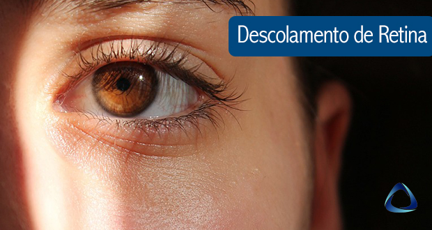Descolamento de Retina - Instituto Abathon