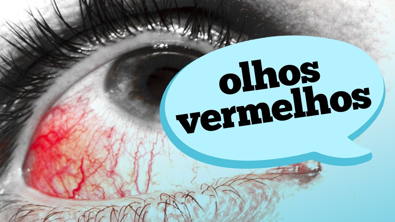 O QUE CAUSA OLHOS VERMELHOS? - Instituto Abathon